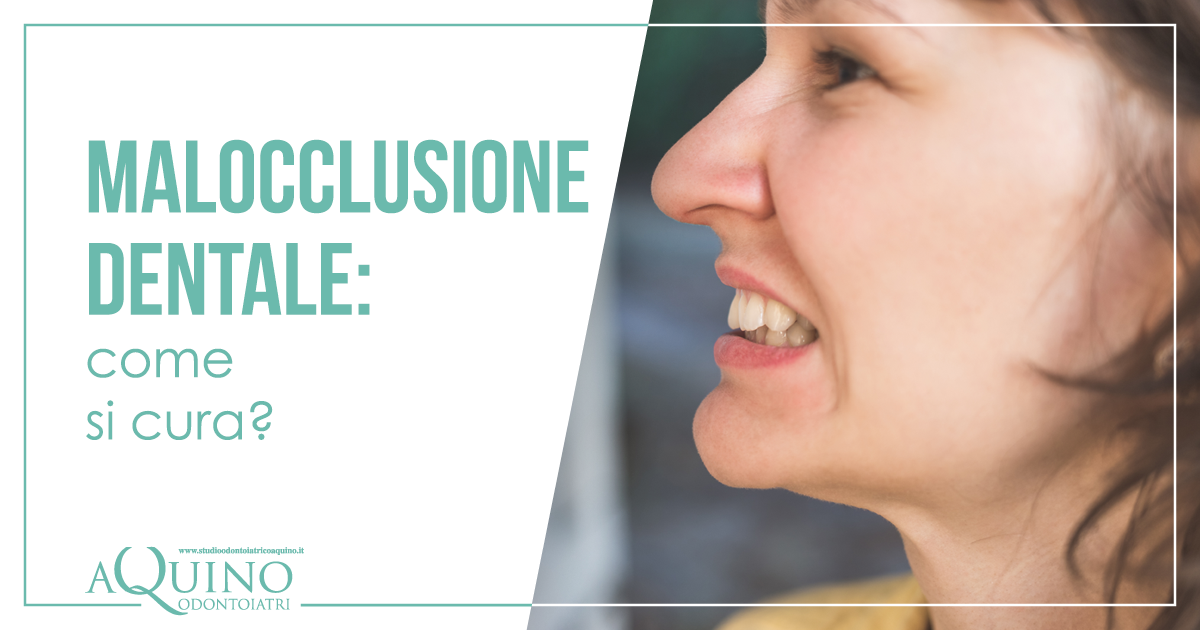 Come si cura la malocclusione dentale? | Studio Aquino